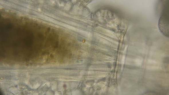 Work and Structure of the Internal Organs of the Cyclops Under the ...