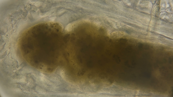 the Work and Structure of the Internal Organs of the Cyclops Under the ...