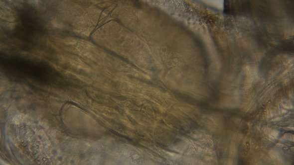 Organs of a Mosquito Larva Under a Microscope, Stock Footage | VideoHive