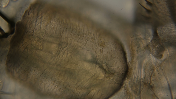 Organs of a Mosquito Larva Under a Microscope, Stock Footage | VideoHive