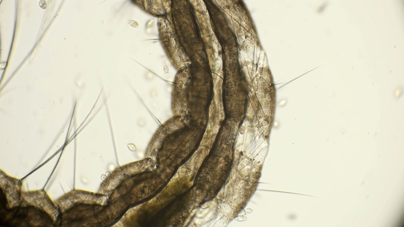 Larva of a Mosquito Under a Microscope, Stock Footage | VideoHive