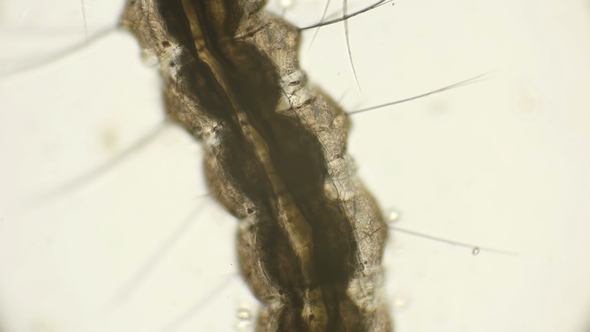 Larva of a Mosquito Under a Microscope, Stock Footage | VideoHive