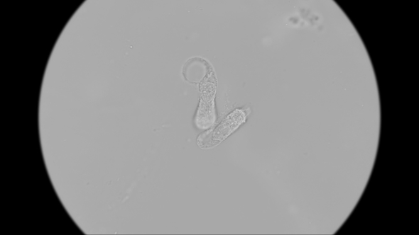 The Ciliated Cells of the Ciliated Epithelium Under the Microscope ...