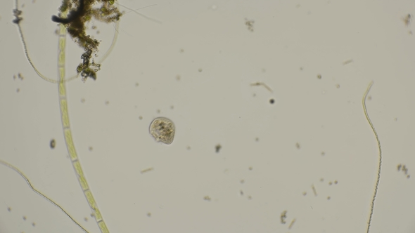 Ciliated Infusoria Under a Microscope, Stock Footage | VideoHive