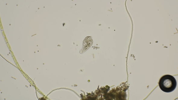 Infusoria-trumpeter Stentor with Oral Cilia under a Microscope, Stock ...