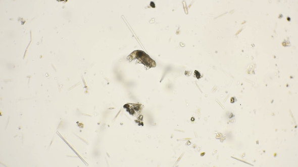 the Most Enduring Organism on the Planet Is the Slow-moving, Under a ...