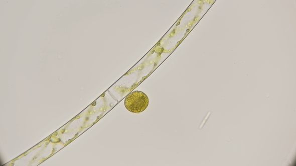 Filamentous Algae Spirogrya Under the Microscope, Stock Footage | VideoHive