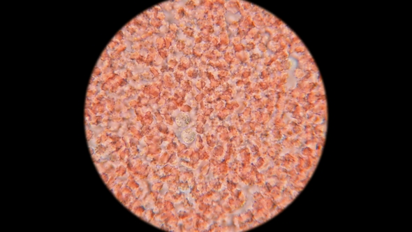 Blood of a Dog Under a Microscope, Stock Footage | VideoHive