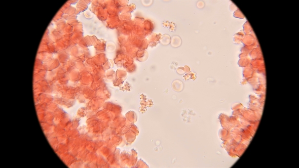 Blood of a Dog Under a Microscope, Stock Footage | VideoHive