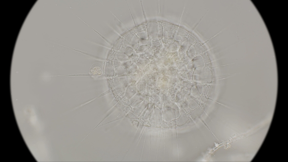 the Simplest Organisms of the Heliozoa Class, Similar To Radiolarians ...