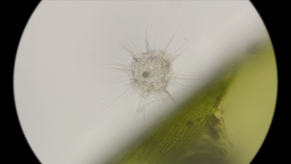 the Simplest Organisms of the Heliozoa Class, Similar To Radiolarians ...