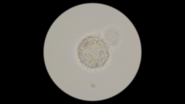 View of Rhizopoda under a Microscope, Stock Footage | VideoHive