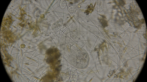 Colony Infusoria Shoe Under a Microscope, Stock Footage | VideoHive