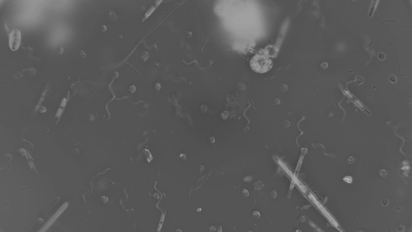 Colony of Bacteria Spirochetes Under a Microscope, Stock Footage ...