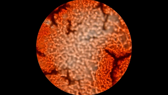 Coagulated Dried Blood Under a Microscope, Stock Footage | VideoHive