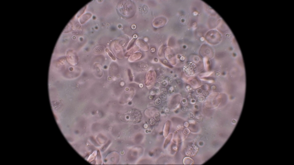 Blood of a Fish Under a Microscope, Stock Footage | VideoHive