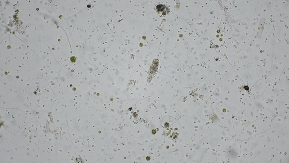 Drop of Water From a Pond with Many Microorganisms Under a Microscope ...