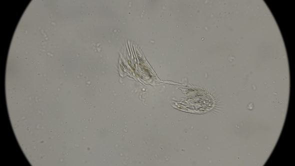 Wrong Development Infusoria Shoe Under a Microscope, Stock Footage