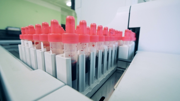 Medical Machine Checks Tubes with Blood, . Blood Samples Move on a ...