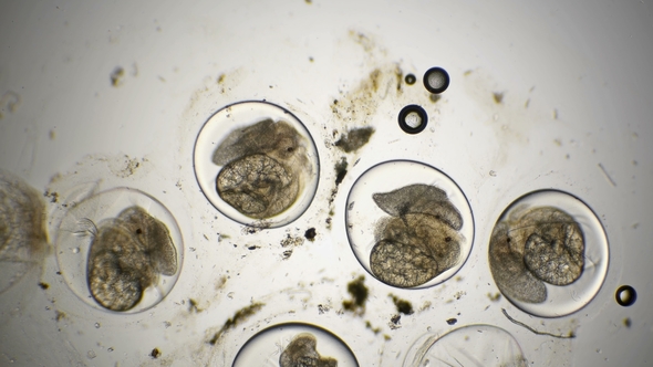 Moving the Eggs Snails Planorbis in Time Laps, Under a Microscope ...