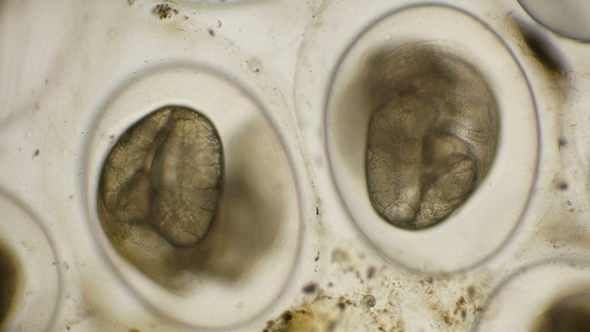 Moving the Eggs Snails Planorbis in Time Laps, Under a Microscope ...