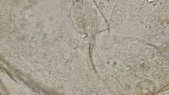 Colony of Bacteria Spirochetes Under a Microscope, Stock Footage ...