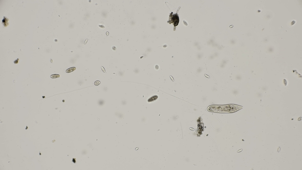 Paramecium Caudatum Infusoria and Many Other Small Protozoa and ...