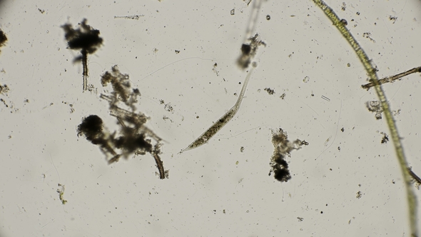 Dileptus in Search of Food Under a Microscope, Stock Footage | VideoHive