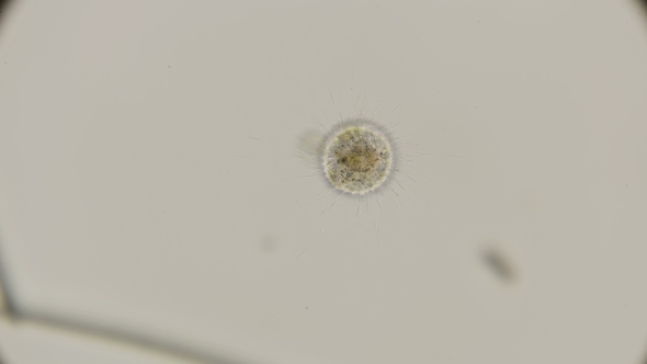 Microorganism Heliozoa, Acanthocystis Under the Microscope, Stock Footage