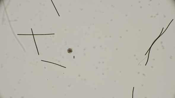 Microorganism Heliozoa, Acanthocystis Under the Microscope, Stock Footage