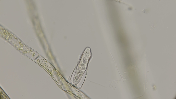 Ciliate Species of Peritricha in the Sink , Under a Microscope, Stock ...