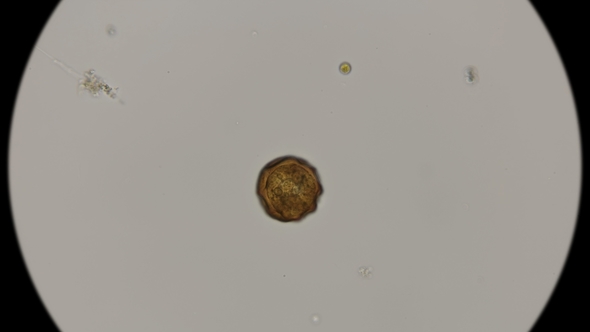 Testate amoeba Arcella gibbosa under the microscope, Stock Footage