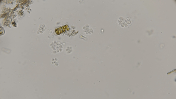 Synura Algae Causing Water To Bloom, Under a Microscope, Stock Footage
