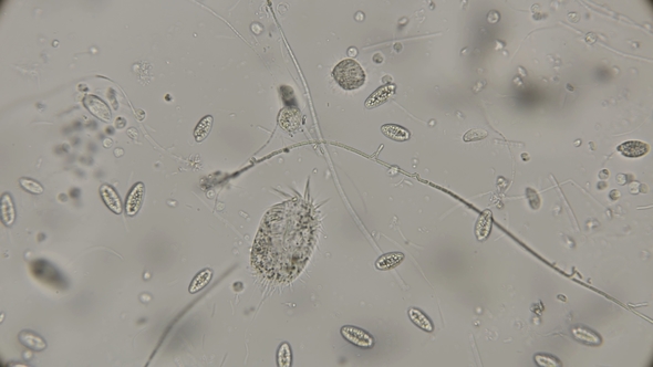 a Large Colony of Various Protozoa Under a Microscope, Stock Footage