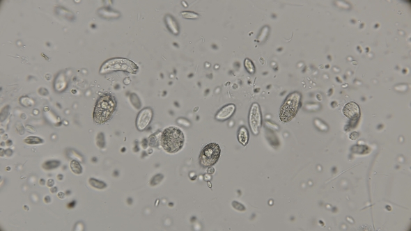 a Large Colony of Various Protozoa Under a Microscope, Stock Footage
