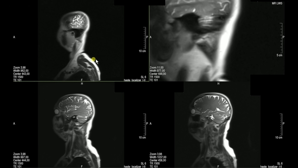 Real MRI Scan of Doctor Examining Brain and Thoracic Spine, Stock Footage