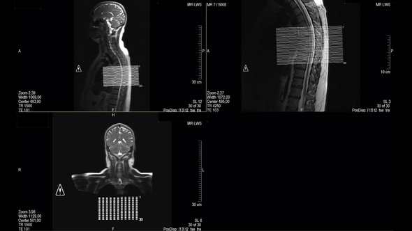 Real MRI Scan of Doctor Examining Brain and Thoracic Spine, Stock Footage