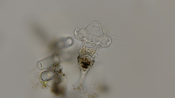 Rotifer Is Kind of Like a Genus of Collotheca Ornata, Under a ...