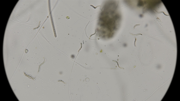 Spiral, Curved Bacterium, a Parasite ,Under the Microscope, Stock Footage