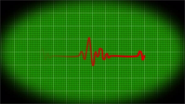Health ECG Heart Beat Line Simulation animation. Vd 1965, Motion Graphics