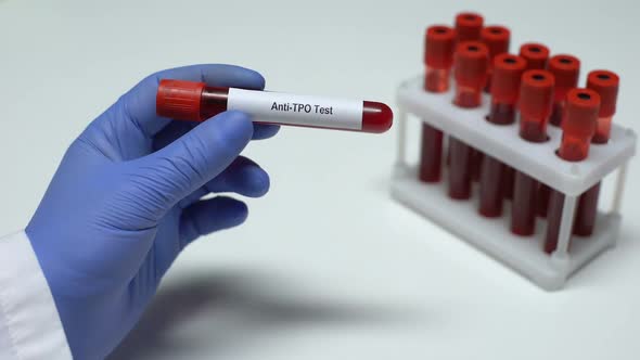 Anti-Tpo Test, Doctor Showing Blood Sample in Tube, Lab Research ...