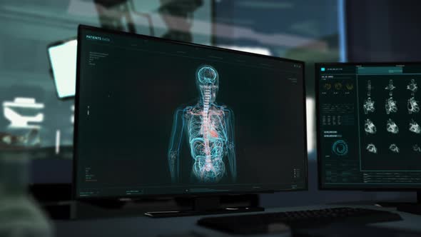 Futuristic x-ray scanner is analyzing the anatomical structure of the ...
