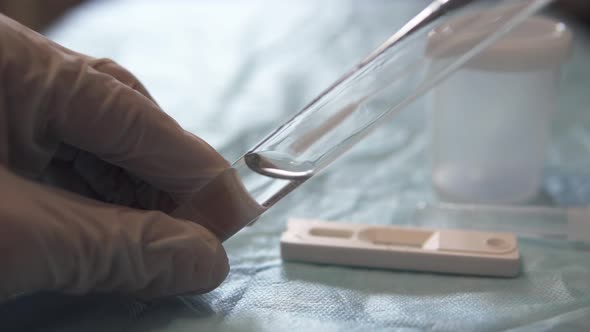 PCR test in the laboratory. The doctor looks at the sample taken to ...
