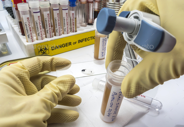Experienced laboratory scientist analyzing a fecal sample Stock Photo ...