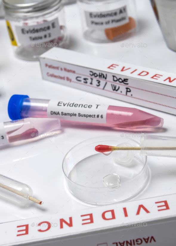 Hematological analysis with forensic test kit in a murder in a crime ...
