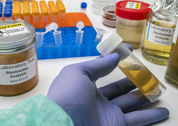 Scientific analysis of wastewater sample in laboratory Stock Photo by ...