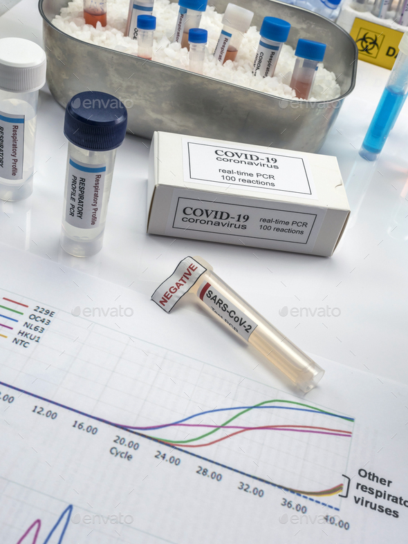 Novel coronavirus 2019 nCoV pcr diagnostics kit Stock Photo by ...