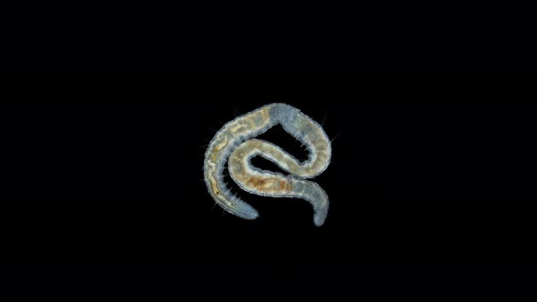 worm Nais sp. under a microscope, Family Naididae, a class of ...