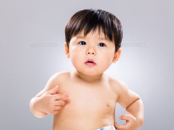 Baby scratch his body Stock Photo by leungchopan | PhotoDune