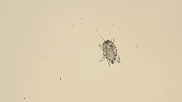 a Granary or Flour Mite Under a Microscope, Stock Footage | VideoHive